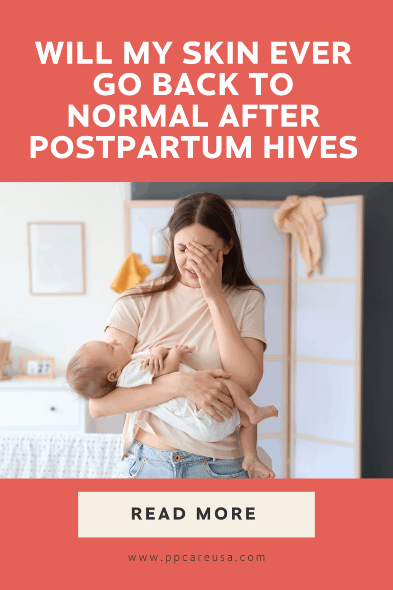 Postpartum Urticaria: Understanding and Managing Hives & Dry Skin After ...