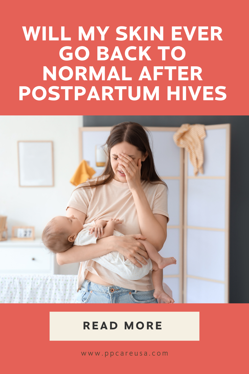 Postpartum Urticaria: Understanding and Managing Hives & Dry Skin After ...